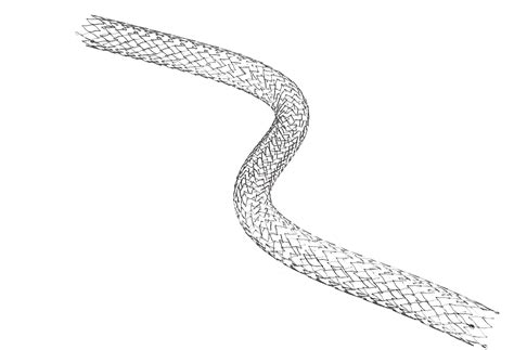 Optimeds Tentos 4 F Stent System Launched In Europe And Other Ce Mark
