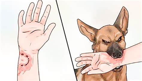 Bệnh Dại Là Gì Bệnh Viện Lê Lợi