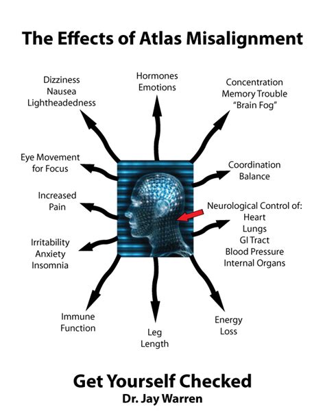 How To Diagnose Atlas Misalignment At Stephanie Wolfe Blog