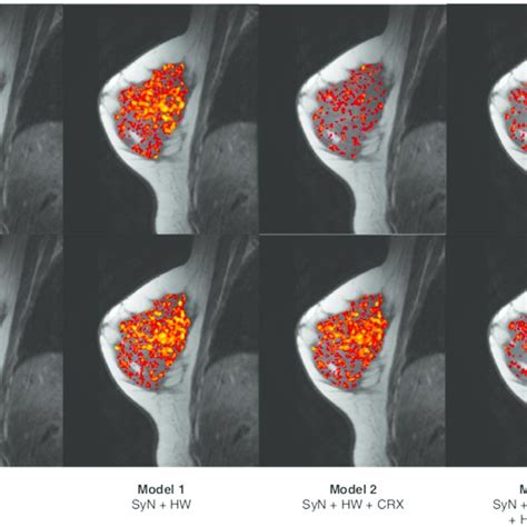 Activation Maps Showing Magnitude Of Correlation Coefficients P