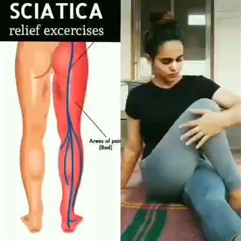 Get Rid Of Sciatica Artofit