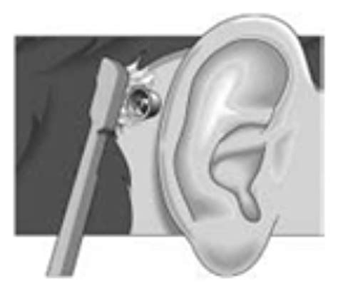 Bcd Bone Conduction Device Bravis