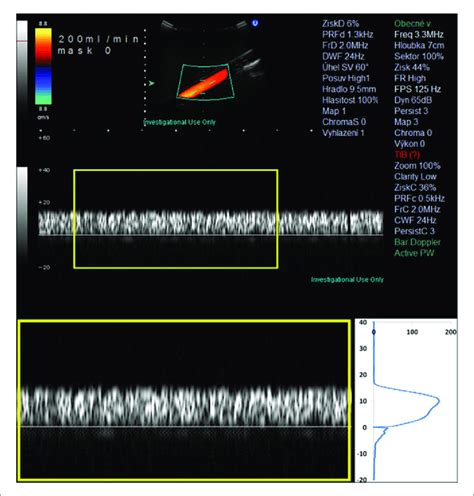 Analysis Of Doppler Spectra Download Scientific Diagram