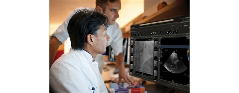 Philips Spotlights Cardiac Care At Esc News Philips