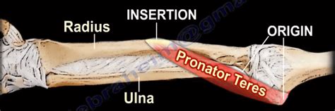 Anatomy Of The Pronator Teres Orthopedics Muscles Anatomy Arm Healthcare