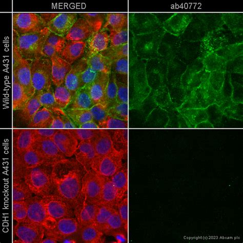 Epithelial Mesenchymal Transition Beta Catenin，vimentin Western Blot