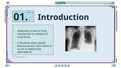 Medical Imaging Presentation Atelectasis Pptx