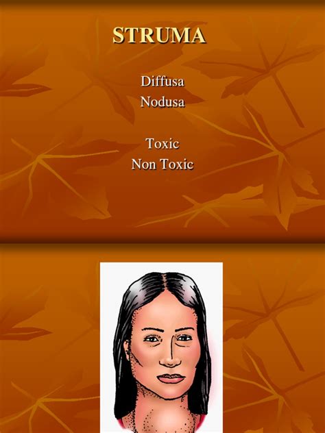 Struma Diffusa Nodusa Pdf