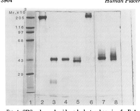 Figure 1 From Human Placental Fetal Fibronectin Increased