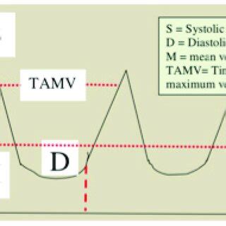 Graphical Presentation Of Doppler Shift To Calculate Doppler Indices Download Scientific