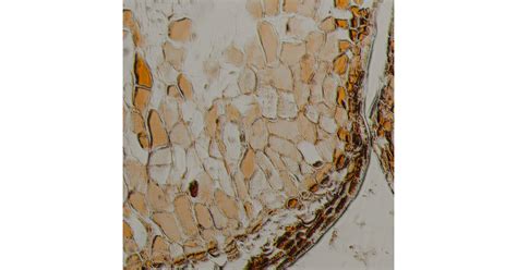 Heavy Metals Panel Lab Analysis For Detox Support