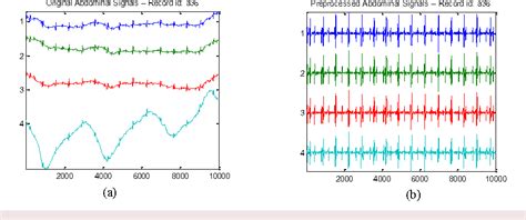 Figure 2 From A Pca Ica Based Fetal Ecg Extraction From Mother Abdominal Recordings By Means Of