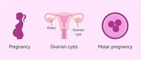 When Is Progesterone High