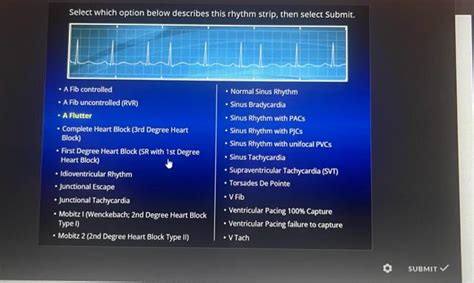 Solved Select Which Option Below Describes This Rhythm Chegg Com
