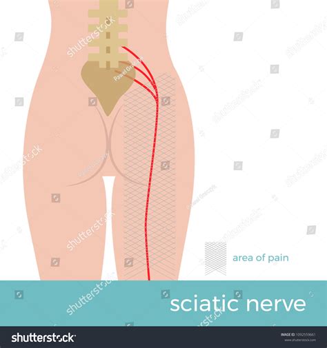 Sciatic Nerve Anatomy Illustration Showing Schematic Stock Vector Royalty Free 1092559661