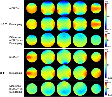 distortions for the t2 w scan for a subset of slices covering the
