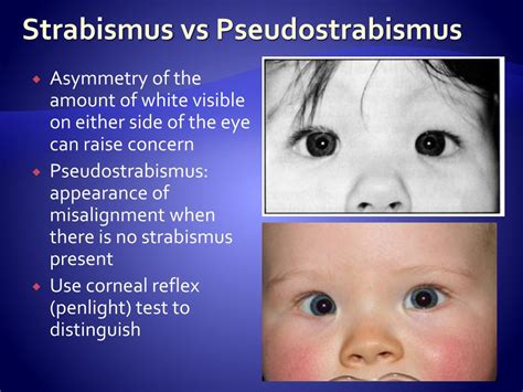 Ppt Preventive Pediatrics Powerpoint Presentation Free Download Id
