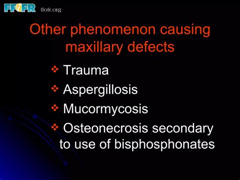 10 Etiology Of Palatal And Paranasal Sinus Defects Ppt Ear Nose