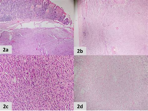 A Microscopy Showing The Ileal Mucosa With Focal Ulceration And Download Scientific Diagram