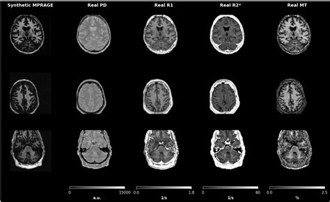 논문 리뷰 Domain Agnostic Stroke Lesion Segmentation Using Physics Constrained Synthetic Data