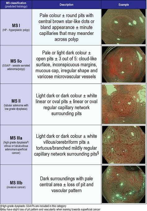Polyps In Colon Size Chart At Paul Caison Blog