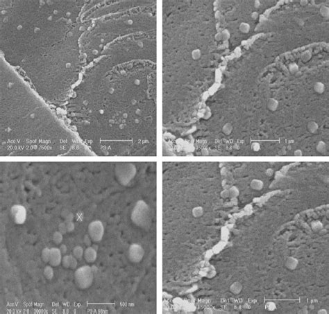 Sem Of Noccs Polymethacrylic Acid Hydrogel Beads With Satranidazole
