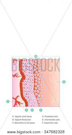 Vaginal Images Illustrations And Vectors Free Bigstock