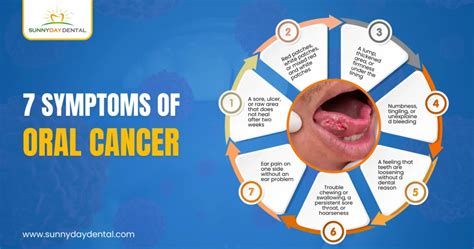 What You Need To Know About Oral Cancer Dentists View