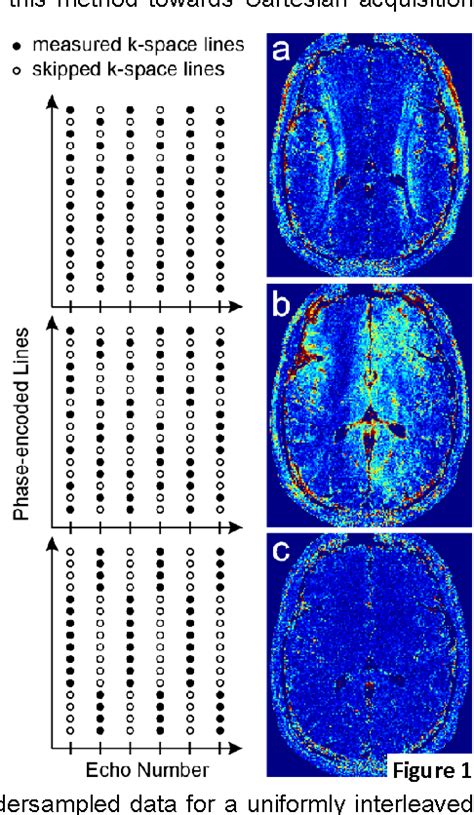 Figure 1 From Nonlinear Inverse Reconstruction For T 2 Mapping From