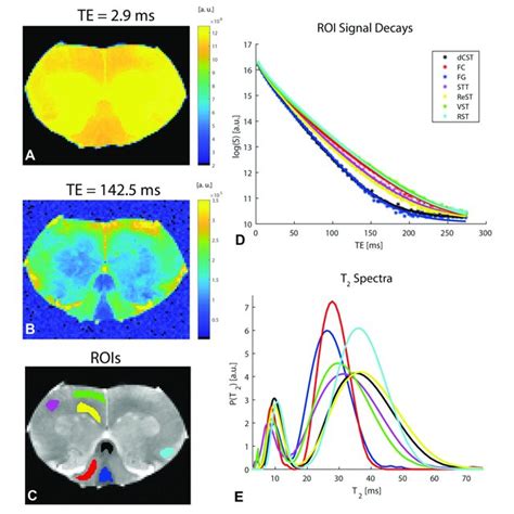 Quality Of Diffusion Mri Data And Preprocessing In A Representative