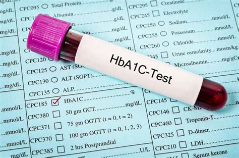 The Facts About A1C Test HealthyU