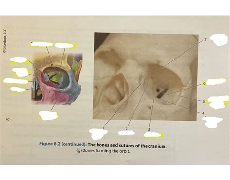 Bones And Sutures Of The Cranium The Orbit — Printable Worksheet