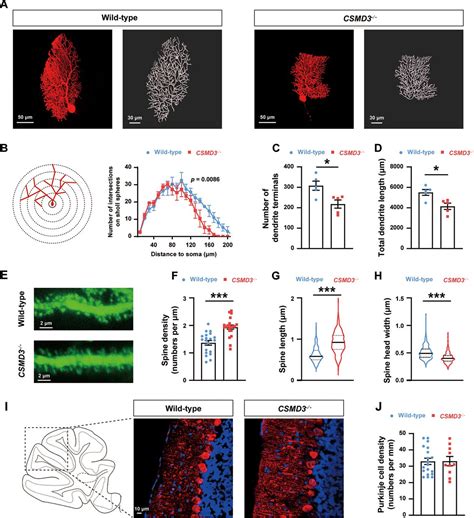 CSMD3 Deficiency Leads to Motor Impairments and Autism-Like Behaviors ...