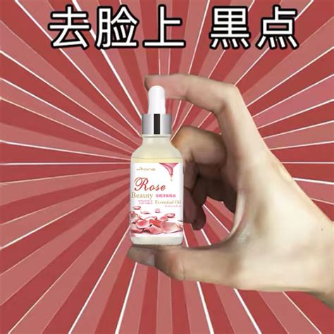 Activity Get Rid Of The Black Spots On Your Face Buy One And Get Two Free For Both Sexes