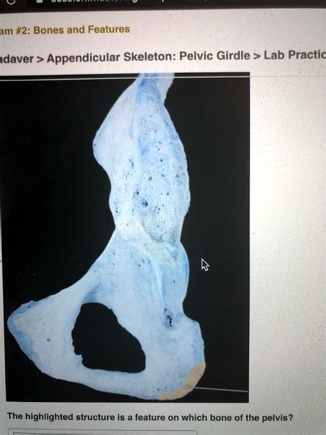 Am 2 Bones And Features Adaver Appendicular Skeleton Pelvic Girdle