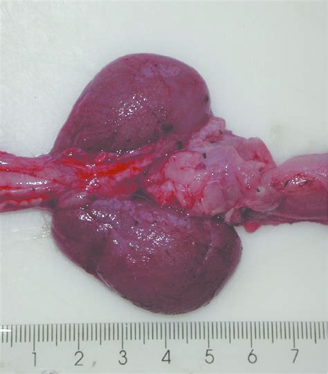 Necropsy Finding Severely Enlarged Thyroid Gland Download Scientific Diagram