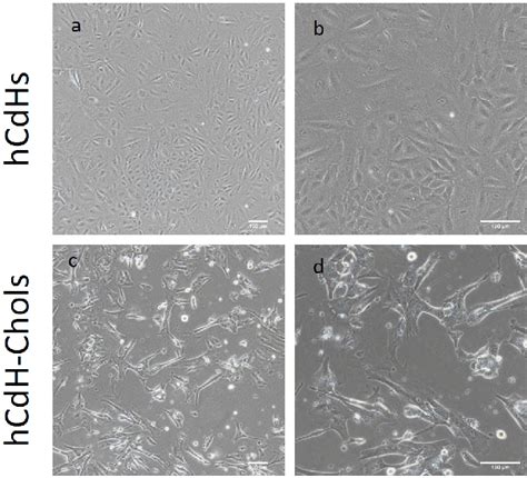 Microscopy Analysis Of Human Cdh And Human Cdh Derived Cholangiocytes