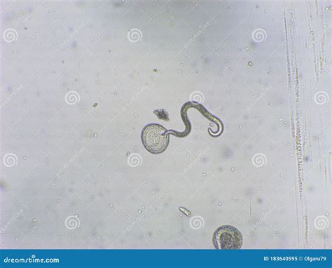 Toxocara Canis Second Stage Larvae Hatch From Eggs Stock Image Image Of Microscopy Nematoda
