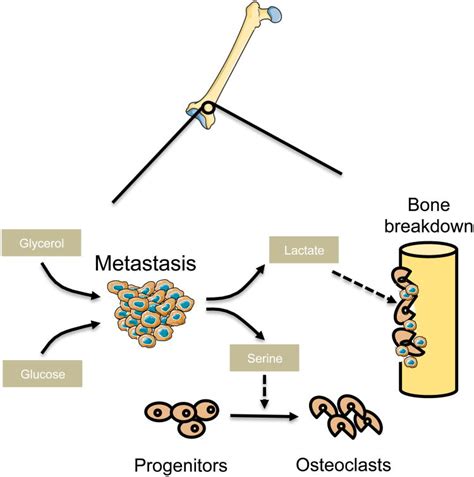 Unique Metabolic Adaptations Dictate Distal Organ Specific Metastatic Colonization Pmc