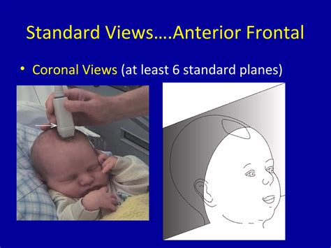 Cranial Ultrasound Of Neonate Ppt