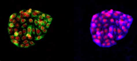 Cell Microarray Scanner Innopsys