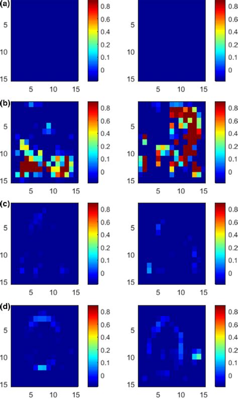 Figure 2 From Nonrigid Registration Of Medical Image Based On Adaptive Local Structure Tensor