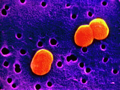 Acinetobacter Calco Aceticus Bacteria By Science Photo Library