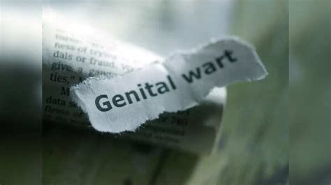 Genital Warts Vs Skin Tags How To Tell The Difference