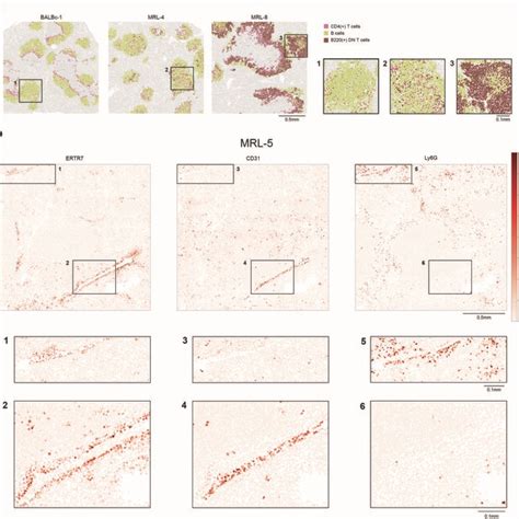 Differences In The Spatial Organization Between Healthy And Systemic Download Scientific