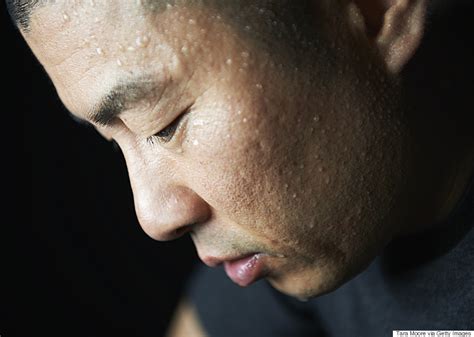 Excessive Sweating Linked To Mental Health Huffpost Canada
