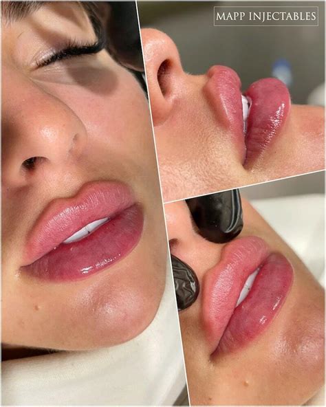 Russian Lips Mfc Share 🌴