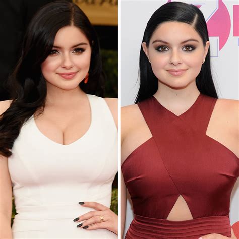 Celebrity Breast Reduction 60 Photos Moonagedaydreamfilm