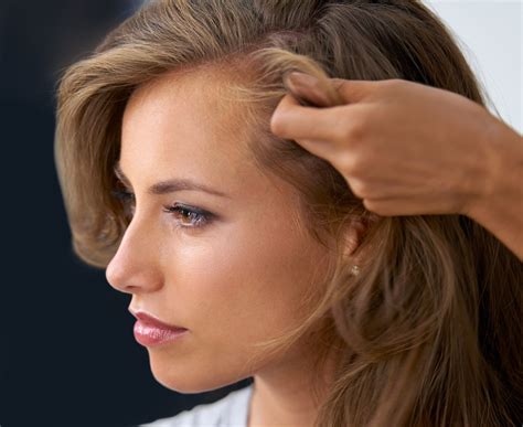 How To Stop A Receding Hairline Women Detroit Chinatown