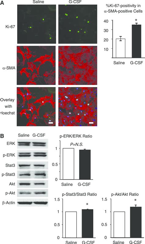 In Vitro Effect Of Granulocyte Colony Stimulating Factor G Csf On Download Scientific Diagram